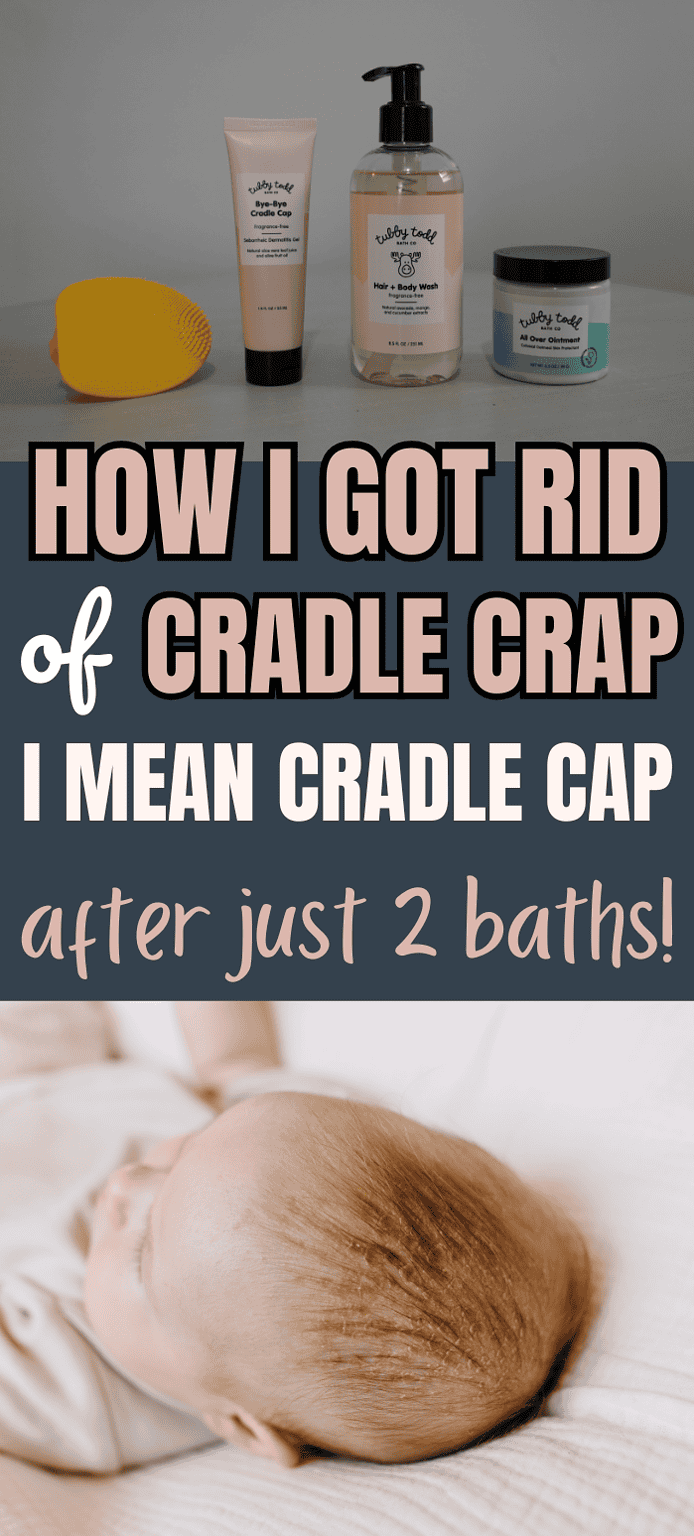 Looking For Cradle Cap Remedies? Here's What Actually Works! | Bump To ...